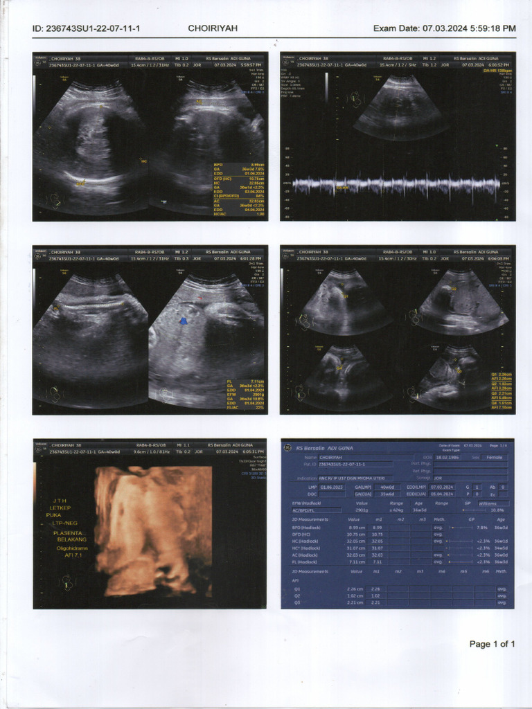 LAST USG (Ultrasonografi) | PDF