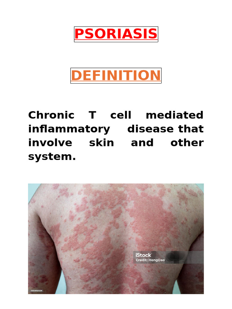 PSORIASIS With Diagrams | PDF