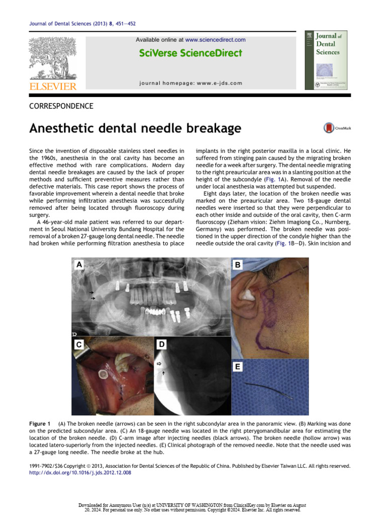 Anesthetic Dental Needle Breakage | PDF