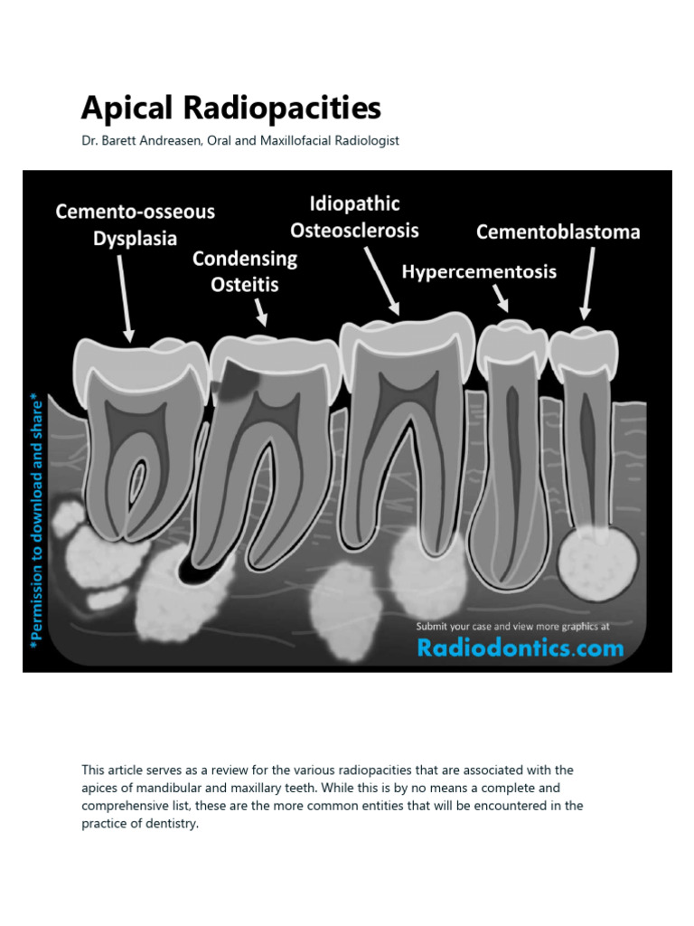 Apical Radiopacities Graphic - Great Resource | PDF