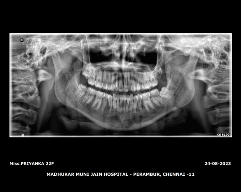 Miss - Priyanka Opg | PDF