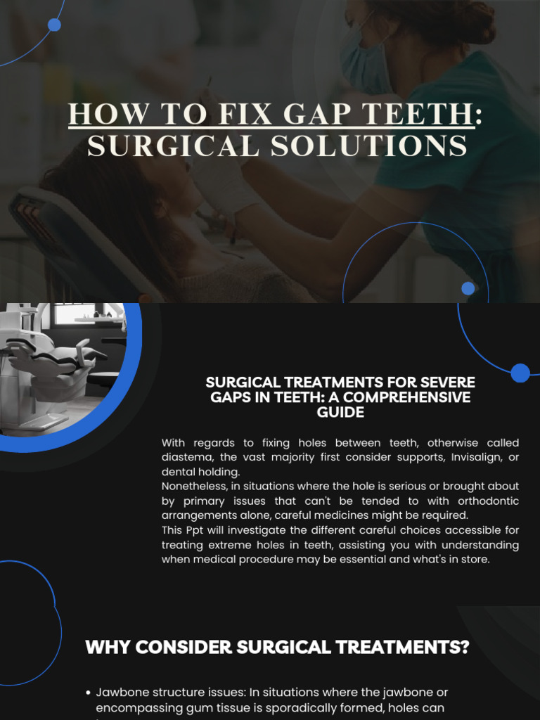 How To Fix Gap Teeth | PDF