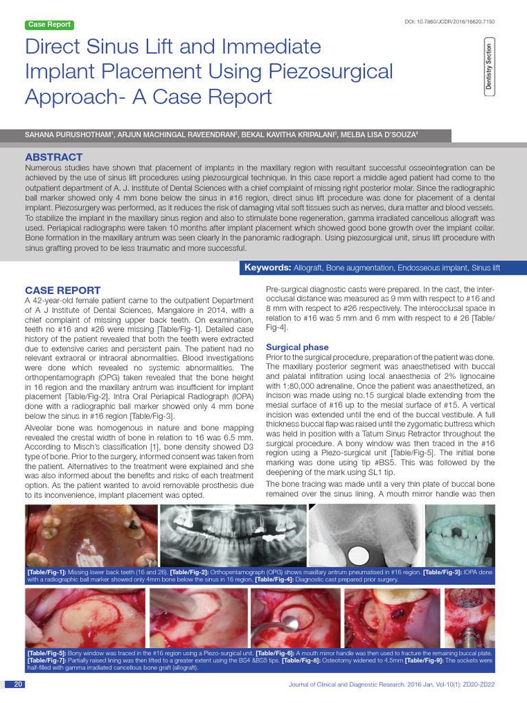 Case Report Direct Sinus Lift | PDF