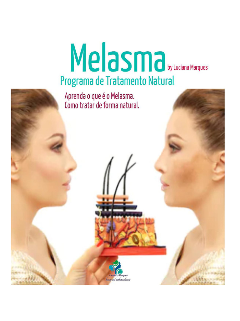 Melasma PTN | PDF