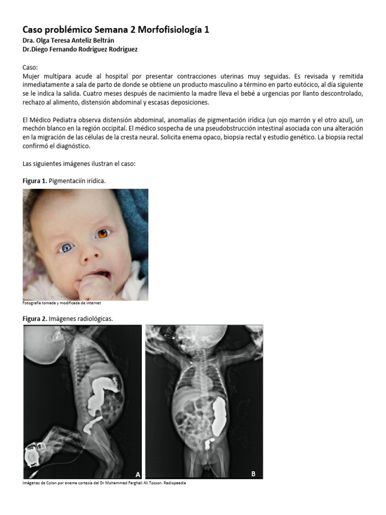 Caso Problémico Semana 2 Morfo 1 | PDF | Especialidades Medicas | Gastroenterología