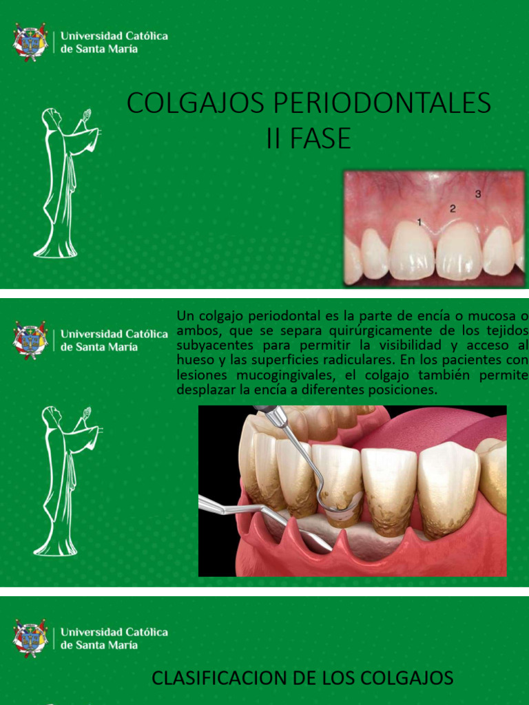 Colgajos Periodontales | PDF