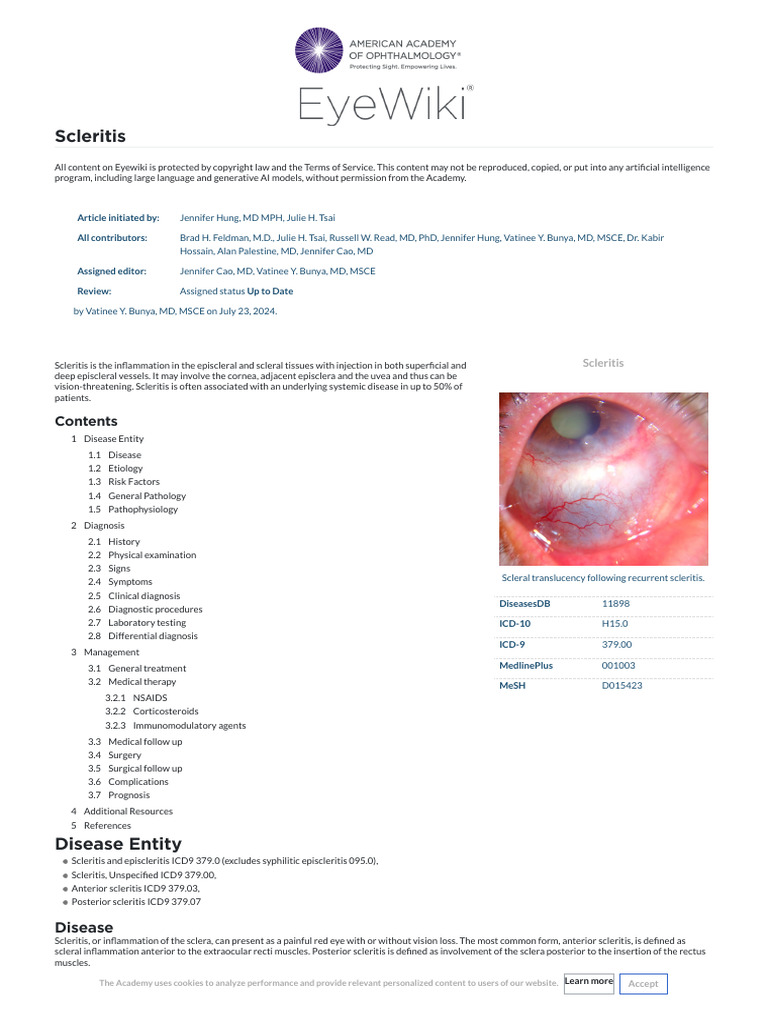 Scleritis - EyeWiki | PDF