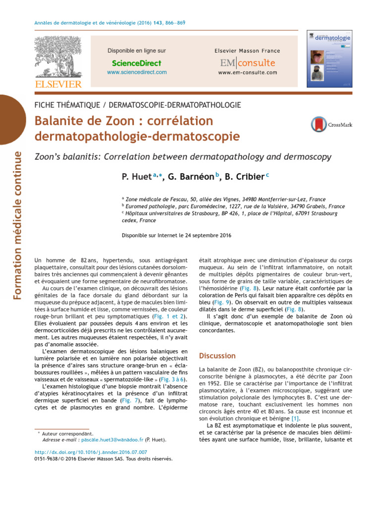 Balanite de Zoon Correlation Dermatoscopie Dermatopathologie | PDF
