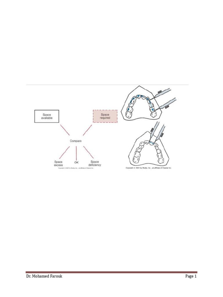 Arch Length Analysis and SM1 | PDF
