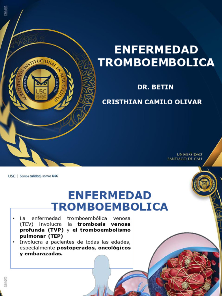 Tema 9 TEP | PDF