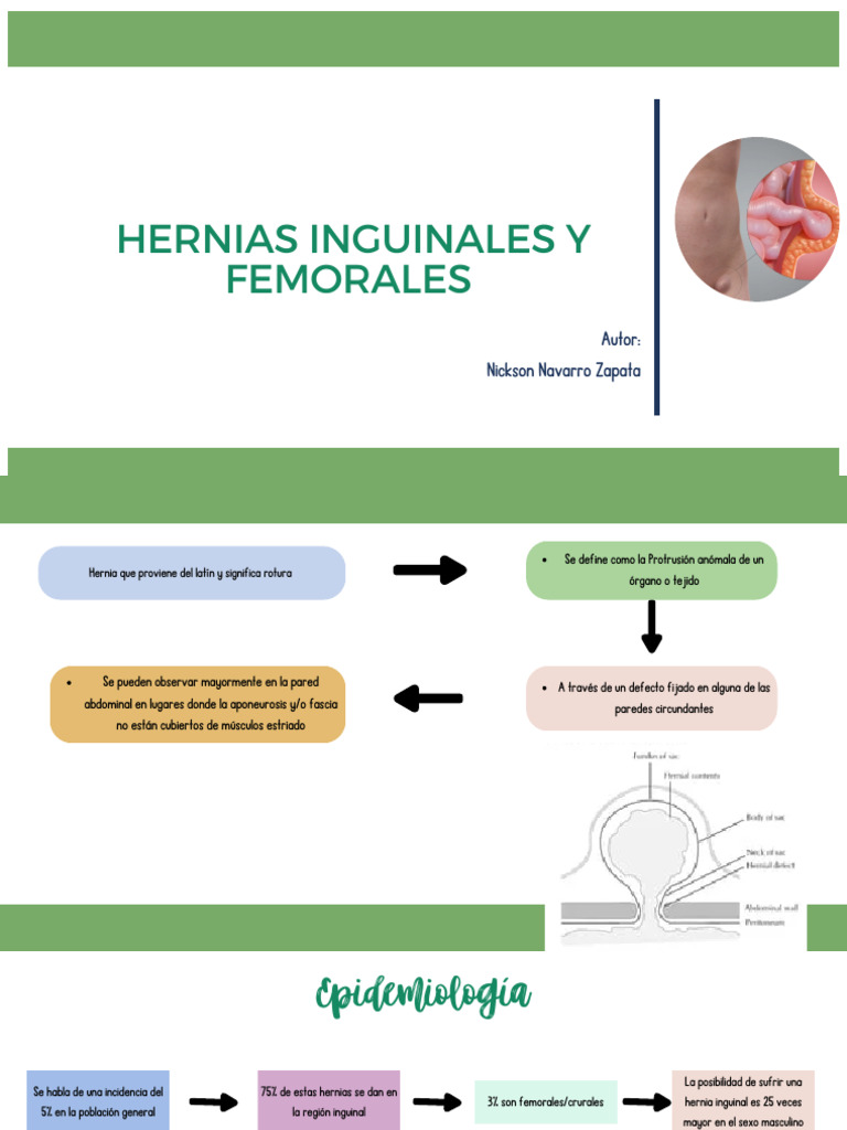 HERNIAS INGUINALES Y CRURAL | PDF