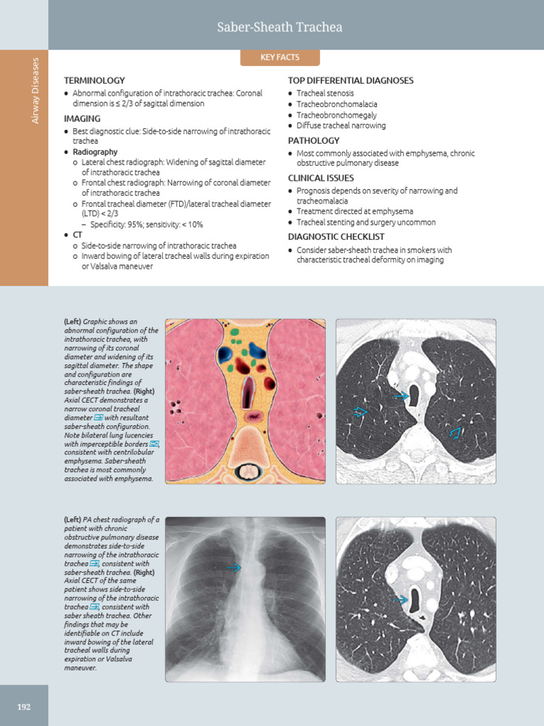 2022 - Diagnostic - Imaging - Chest. (PDF - Io) | PDF