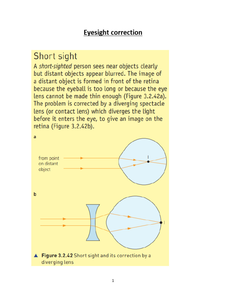 Unit 4 - Eyesight Correction | PDF