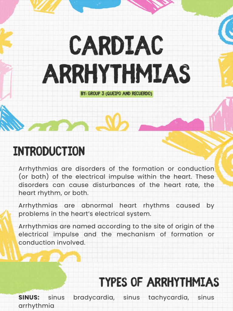 Cardiac Arrhythmias | PDF
