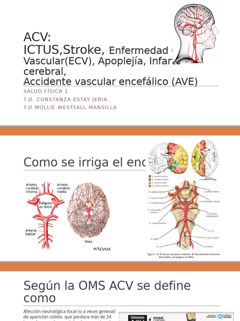 Acv: ICTUS, Stroke,: Enfermedad Cerebro Vascular (ECV), Apoplejía ...