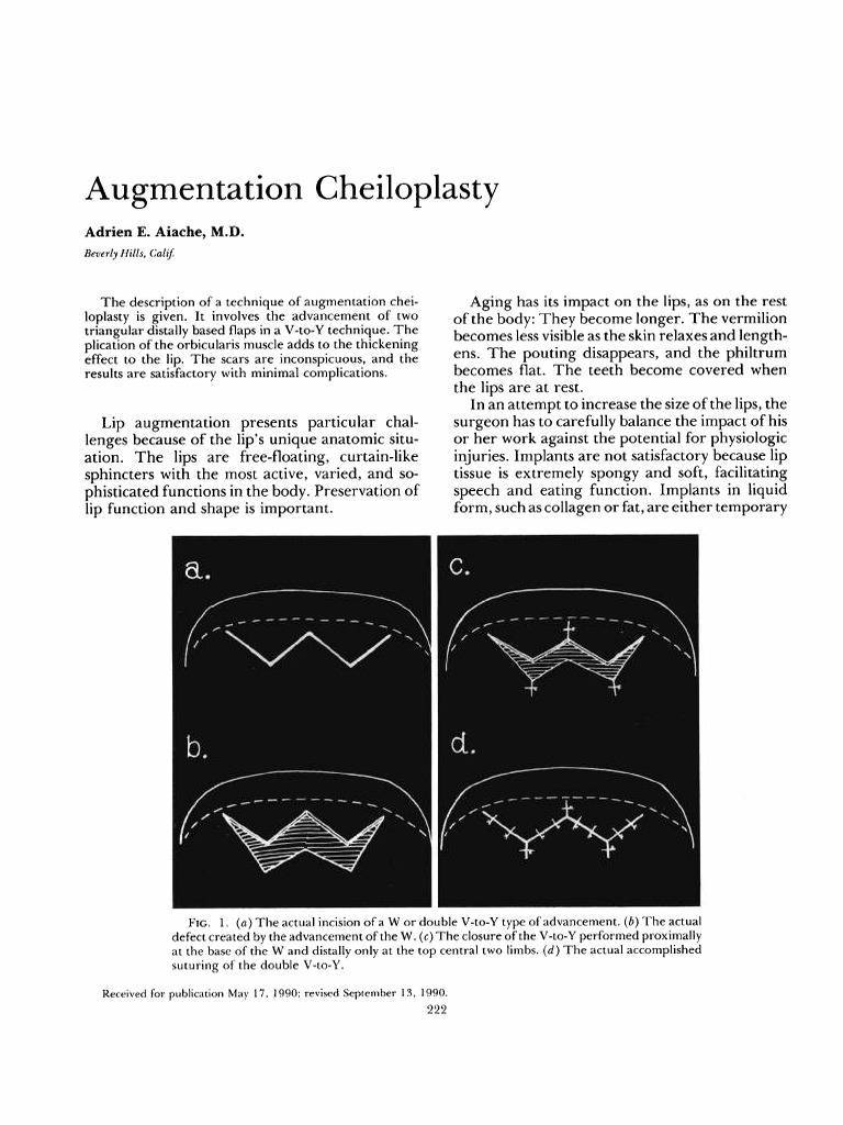 Aiache VY lip augmentation | PDF