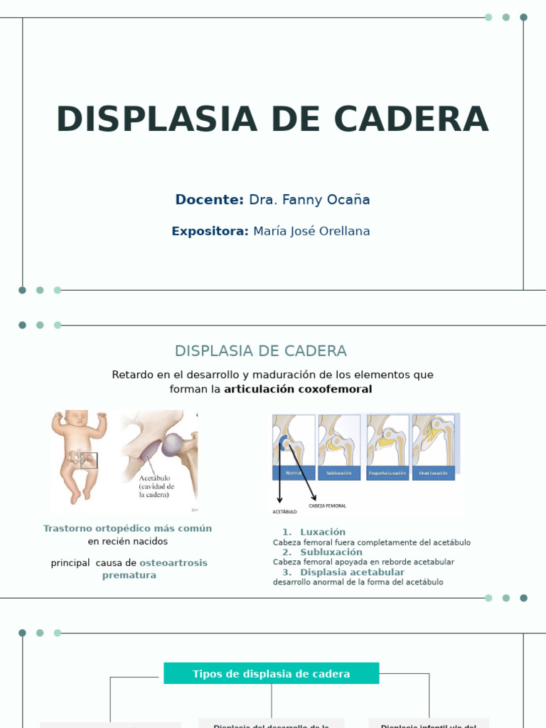 Displasia de Cadera: Diagnóstico y Tratamiento | PDF | Especialidades ...
