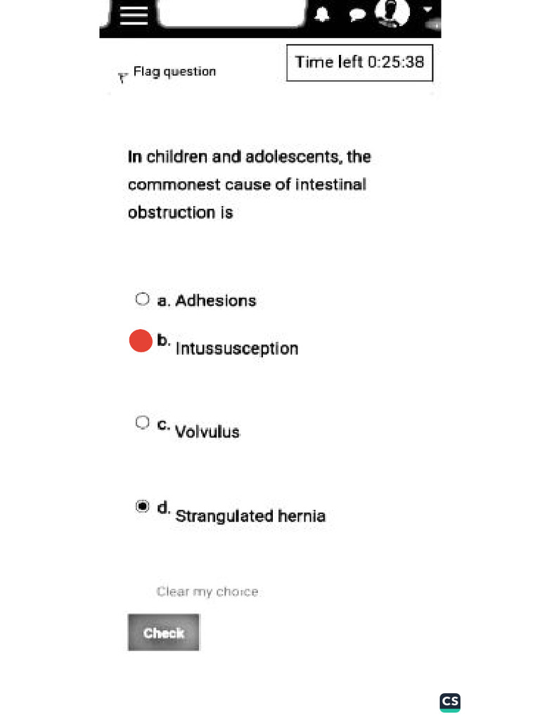 (11% Discussed) MUELE Surgery Progressiv | PDF