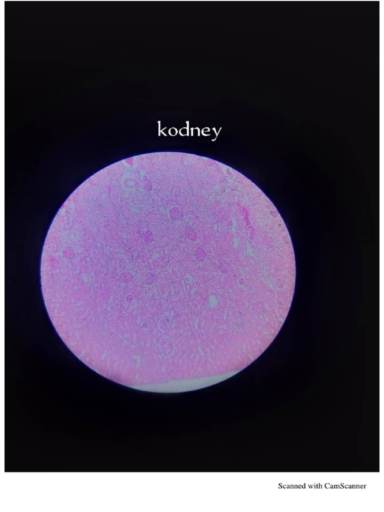 Renal Module GMC (Nabeel) | PDF