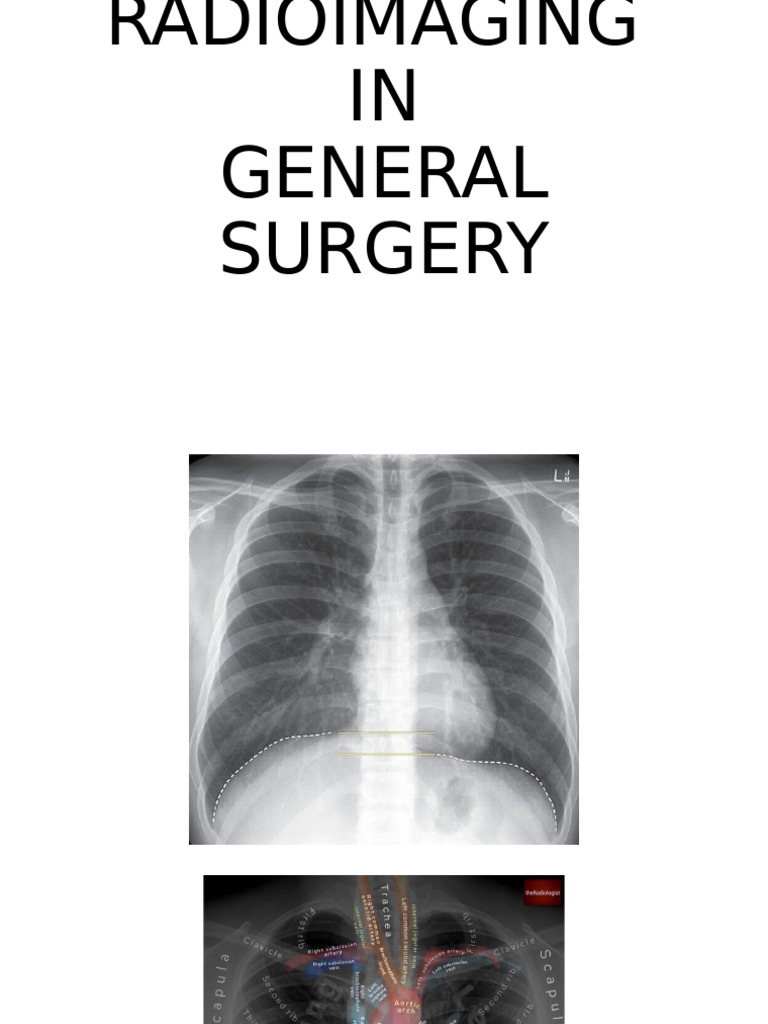 Radioloy in General Surgery-2 | PDF