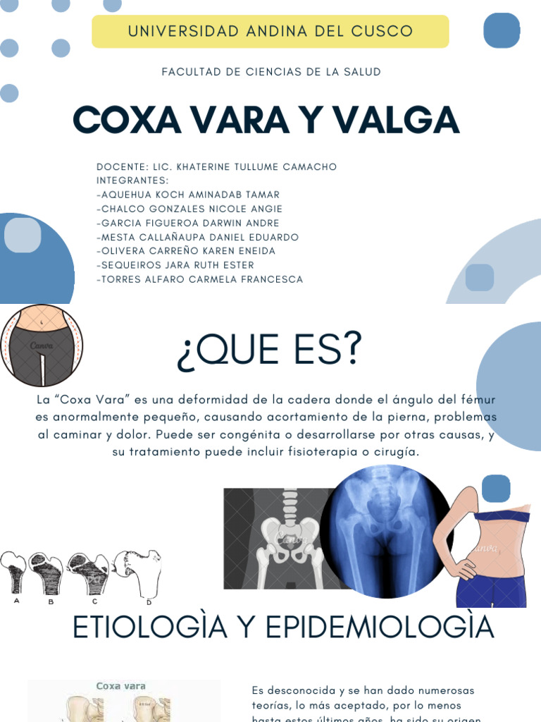 Coxa Vara y Valga | PDF