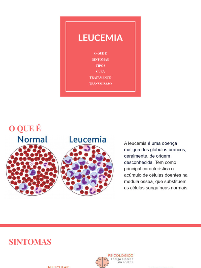 Leucemia | PDF