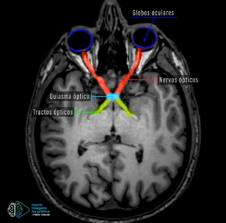 Neurooftalmolpgia DR DILVAN | PDF