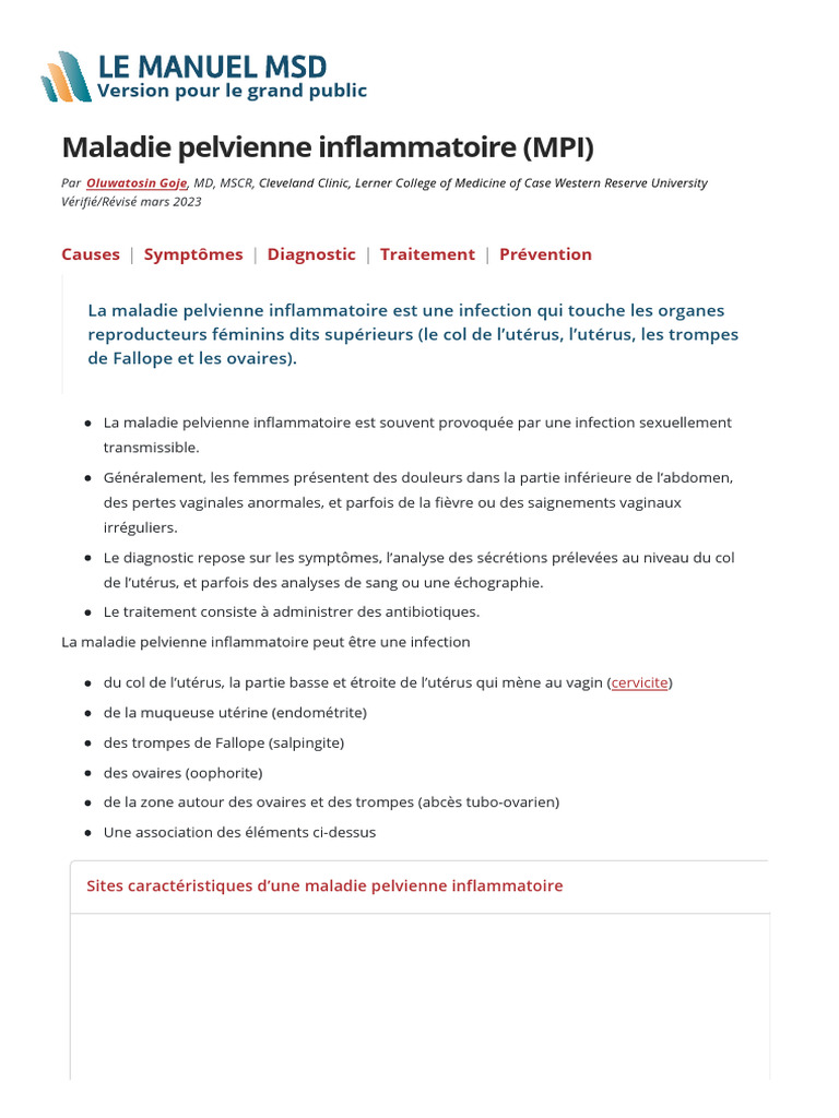 Maladie Pelvienne Inflammatoire (MPI) - Problèmes de Santé de La Femme ...