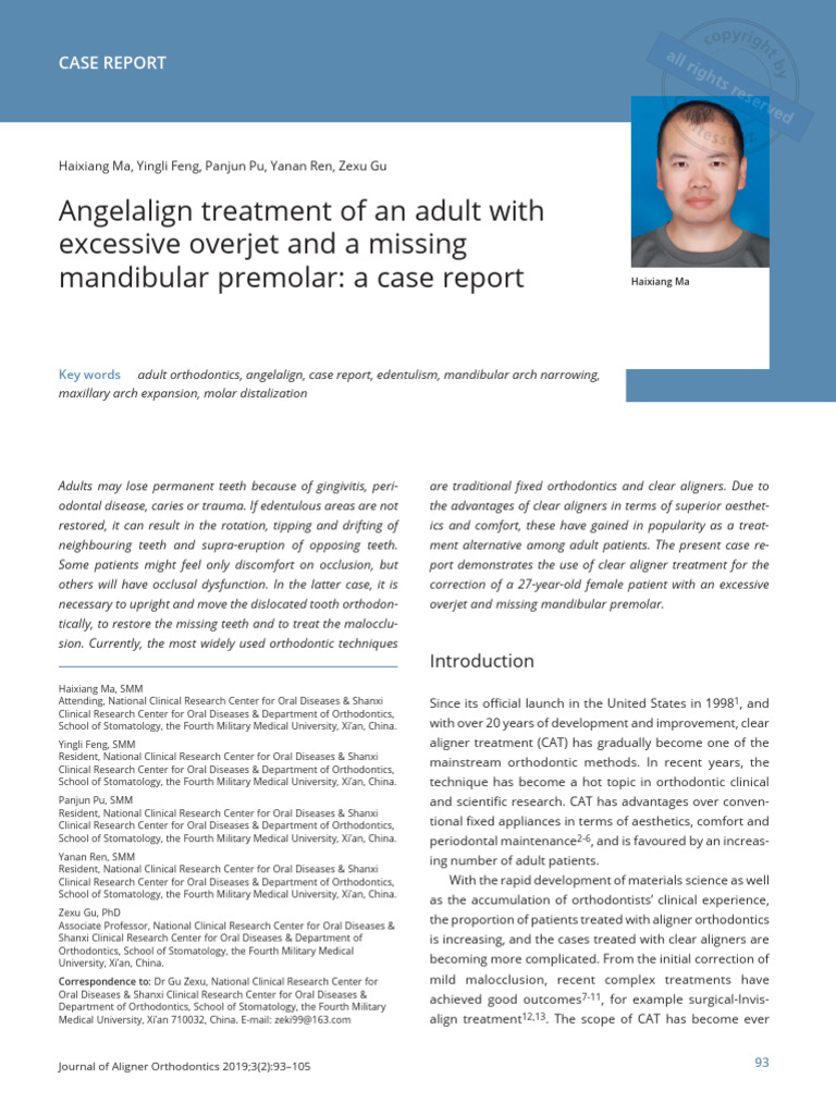 Angelalign for Adult Overjet Correction | PDF | Orthodontics | Mouth