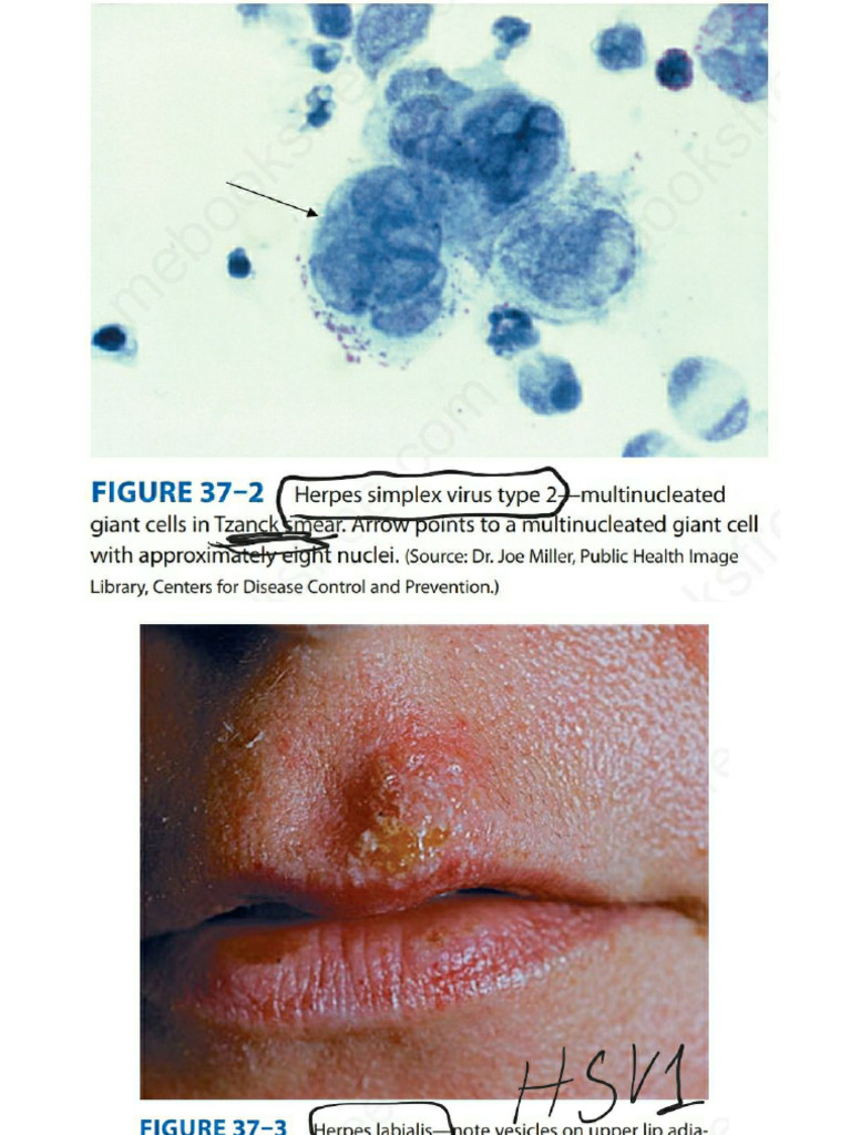 Virus | PDF