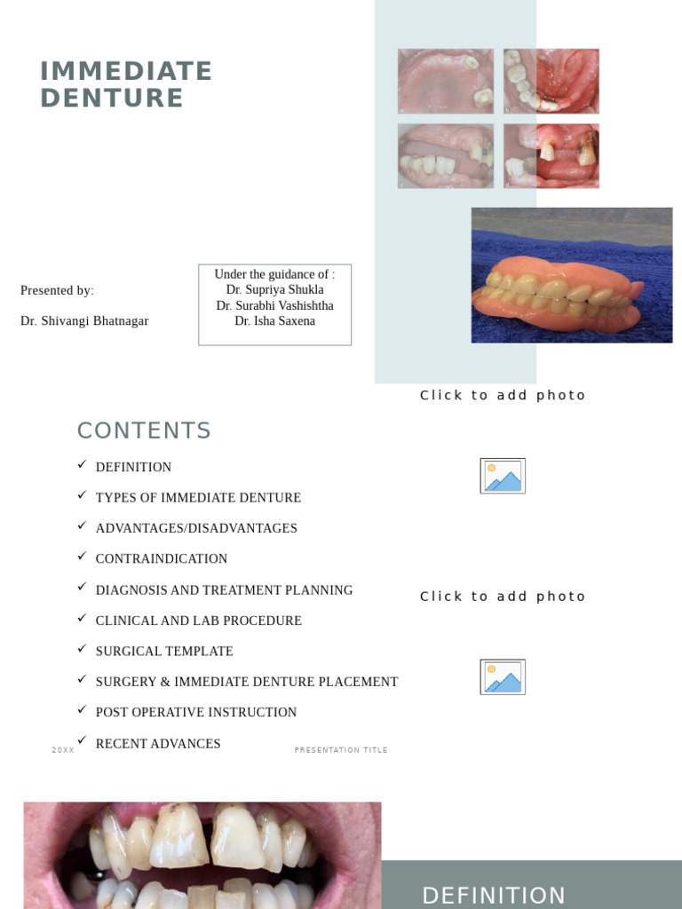 Immediate Denture | PDF | Dentures | Dentistry