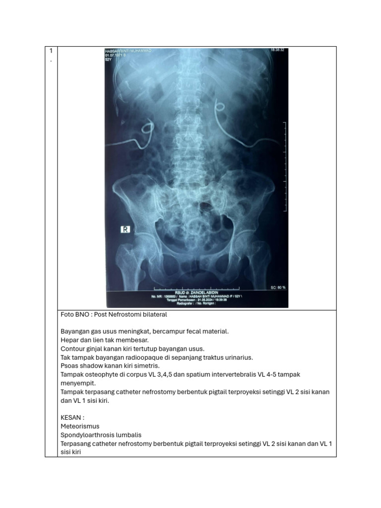 Radiologi | PDF