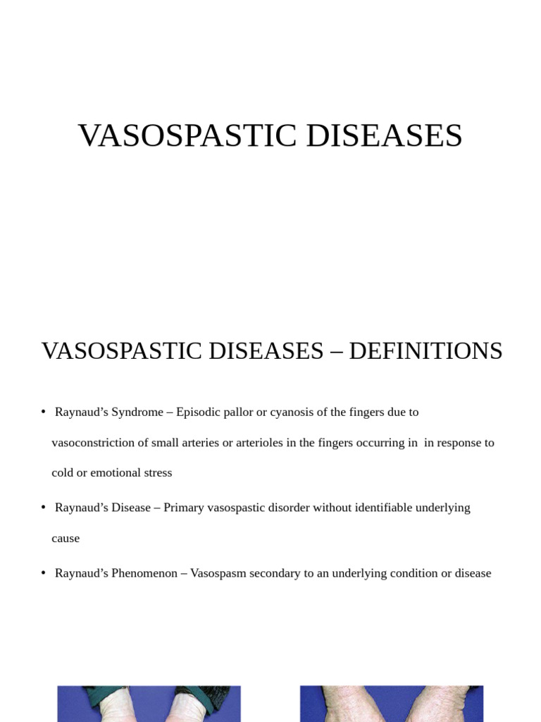 Vasospastic Diseases | PDF