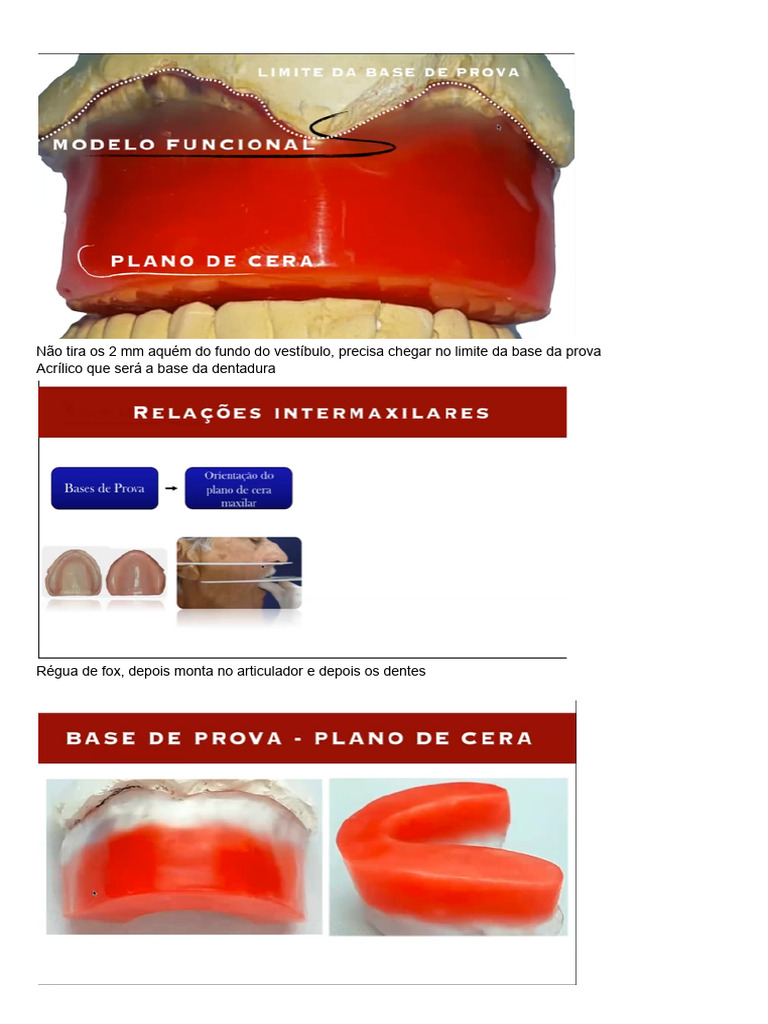 Base de Prova e Plano de Cera | PDF