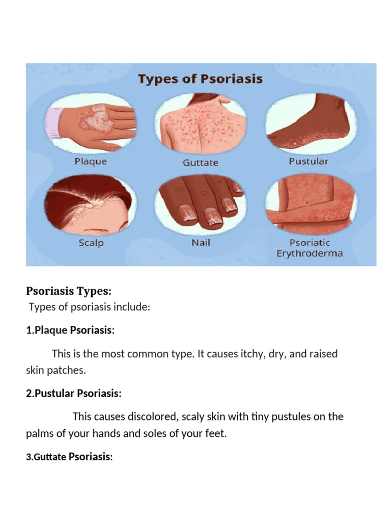 Psoriasis Types | PDF