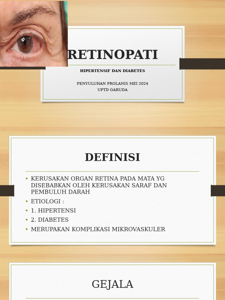 RETINOPATI | PDF