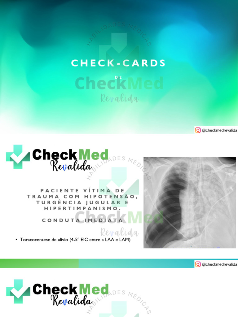Checkmed Revalida - CHECK-CARDS. D2 | PDF