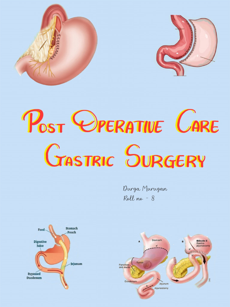 Gastric Surgery Management Pdf