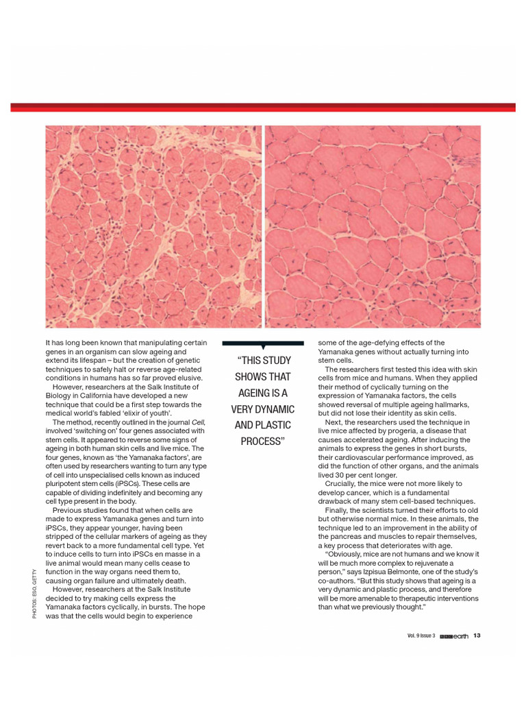 This Study Shows That Ageing Is A Very Dynamic and Plastic Process | PDF
