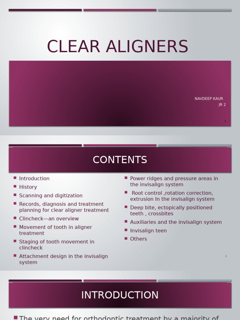 Clear Aligners | PDF