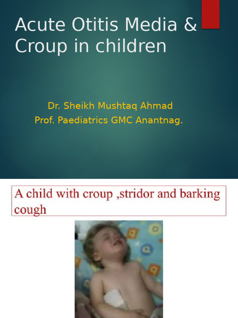 Croup in Children | PDF