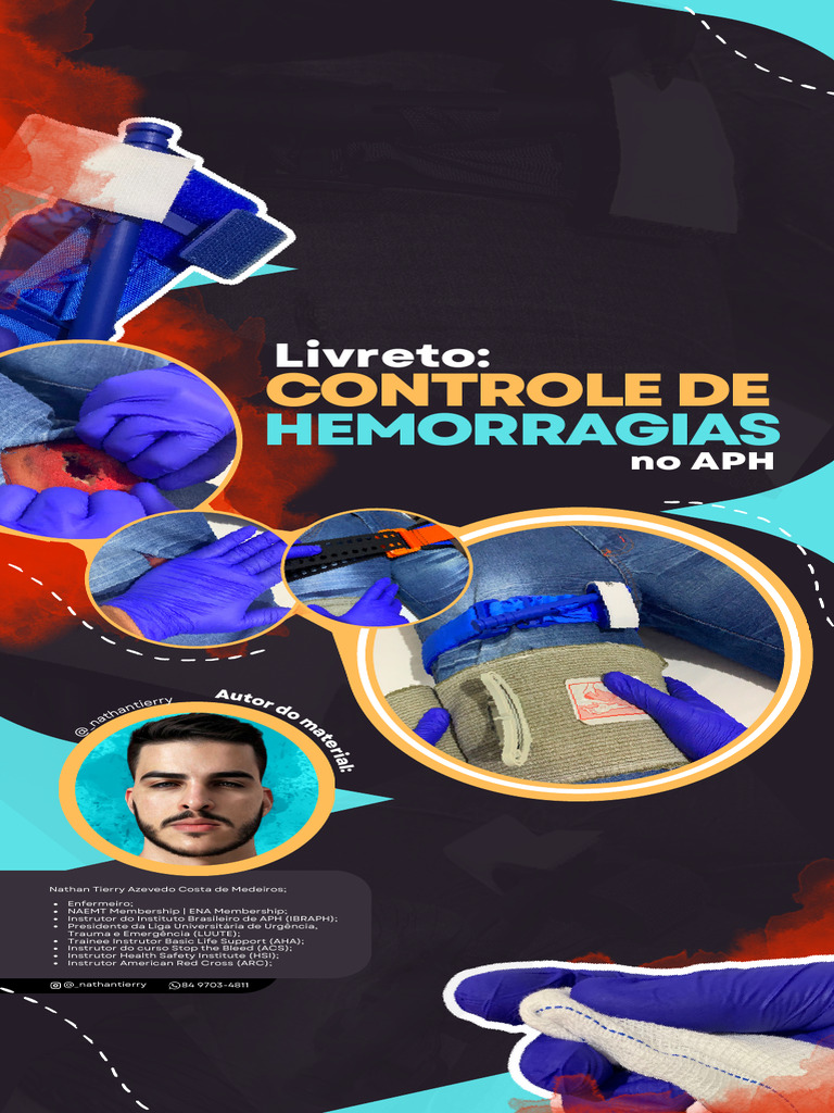 Prévia - Ebook Controle de Hemorragias No APH | PDF