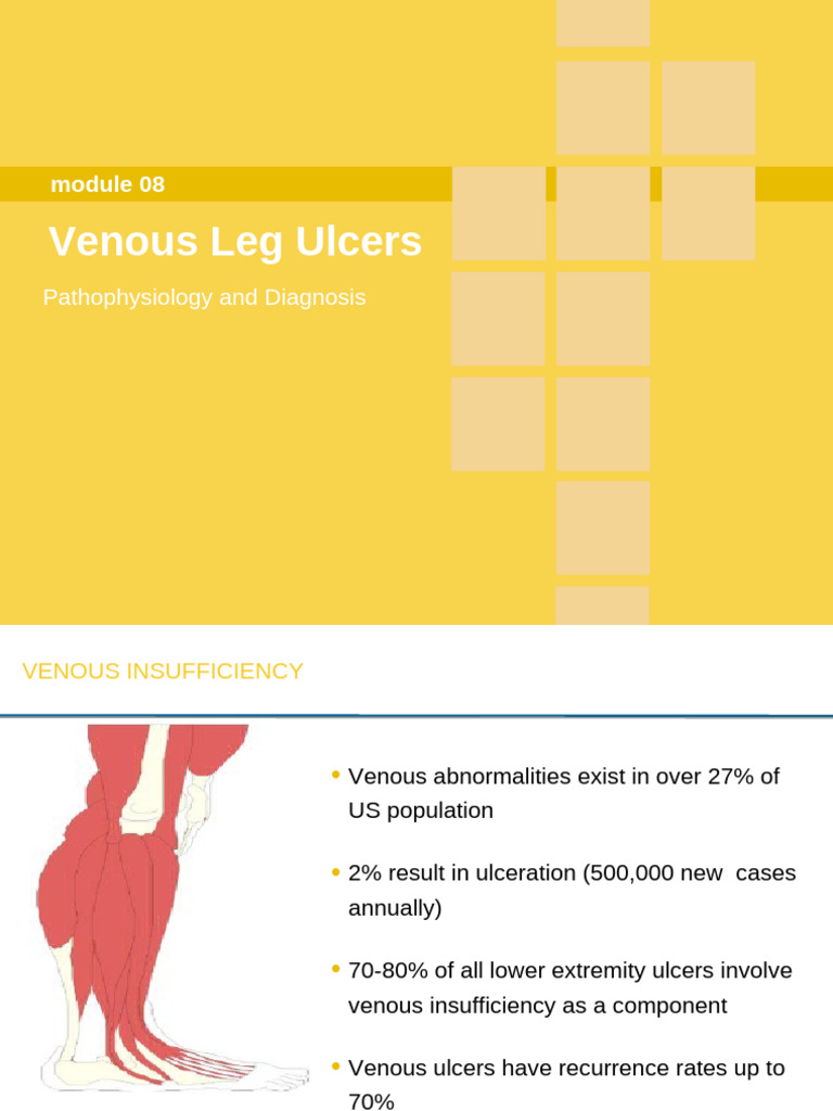 08 - Venous Ulcers | PDF