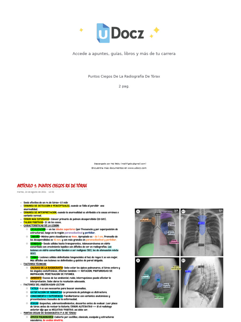 Puntos Ciegos de La 556741 Downloadable 5137372 | PDF