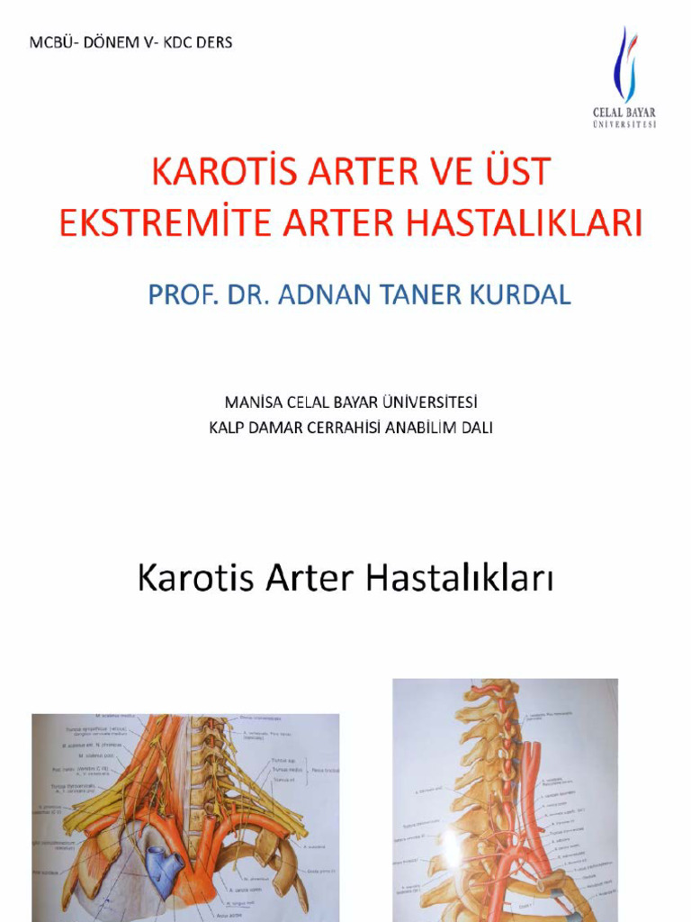 15 Karotis Ve Üst Ekstremite Arter Hast | PDF