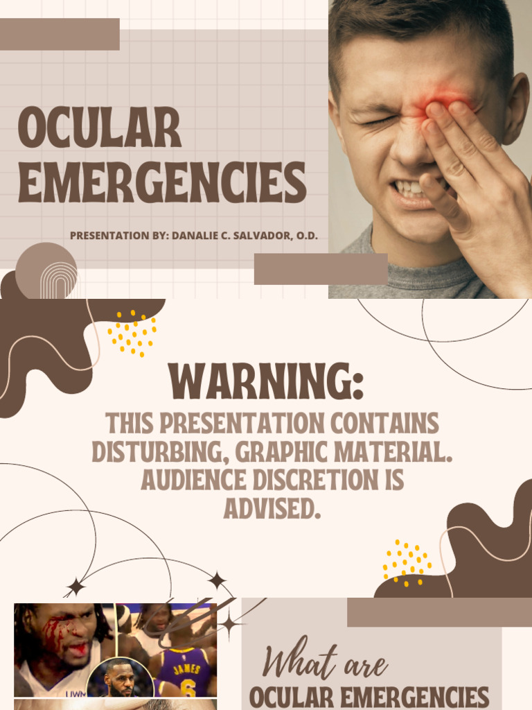 Ocular Emergencies | PDF