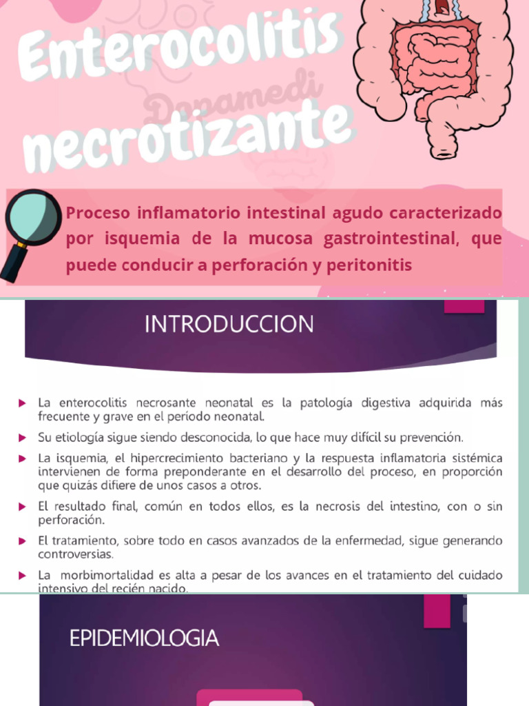 Enterocolitis Nercrotizante | PDF