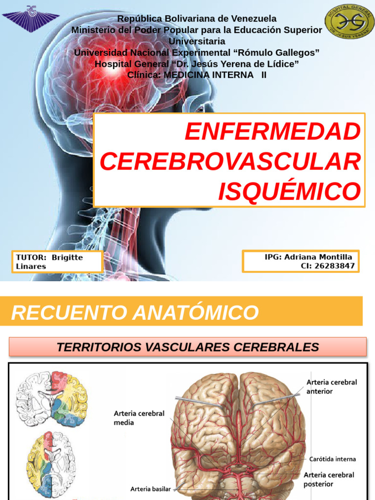 Seminario Ecv Isquemico | PDF