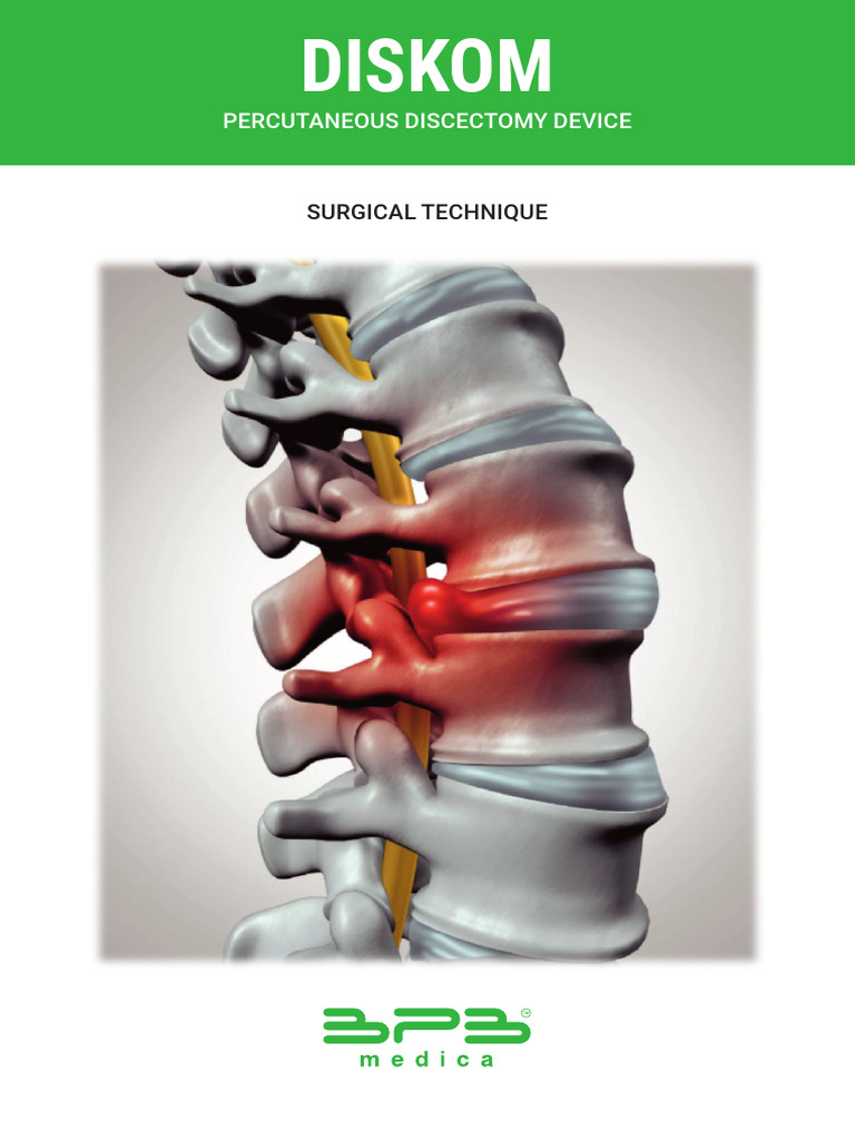 DISKOM Surgical Technique | PDF