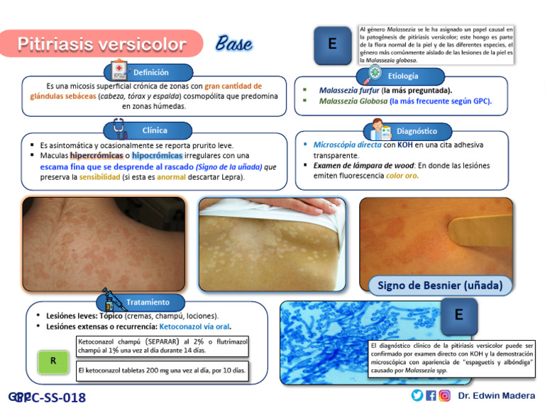 Pitiriasis Versicolor | PDF